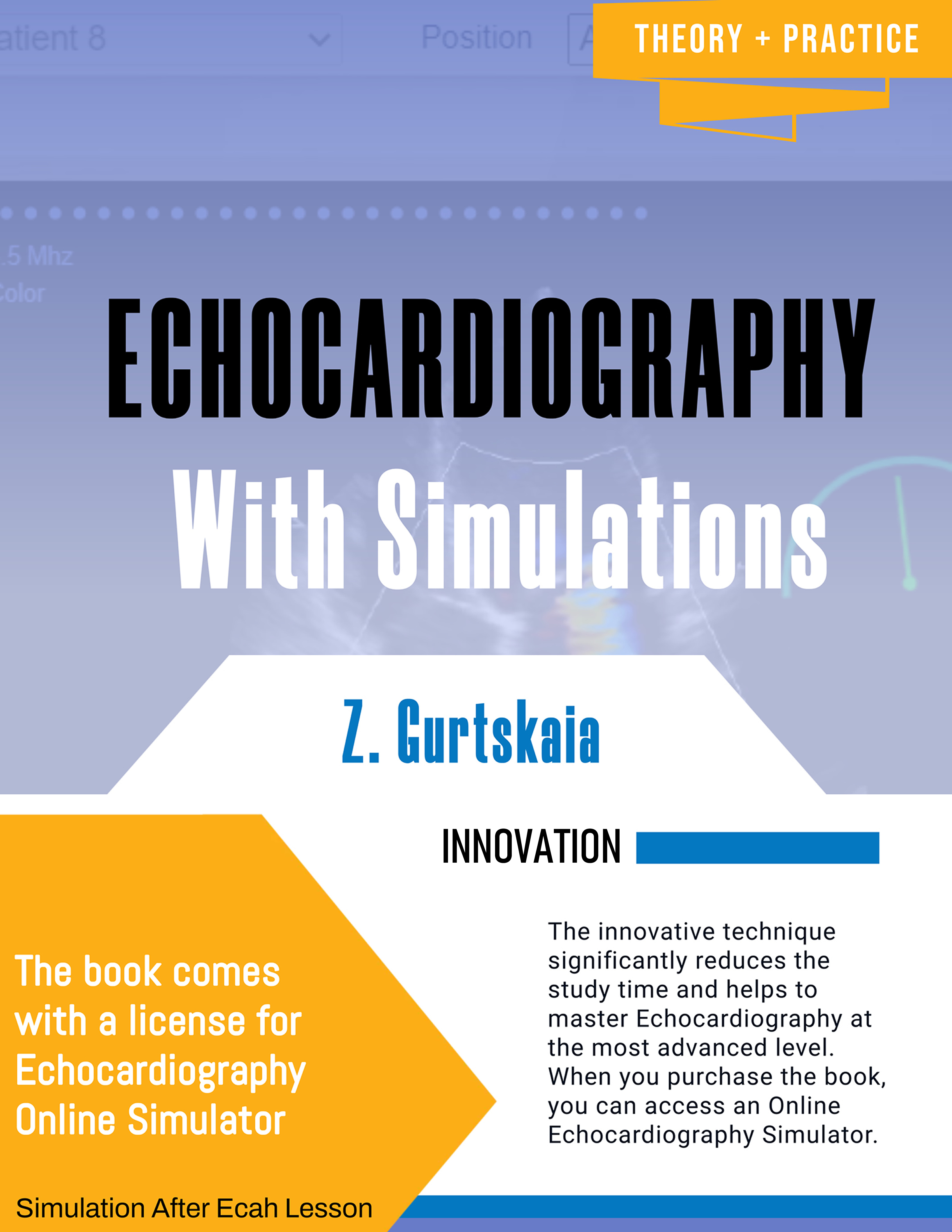 虚拟超声心动图