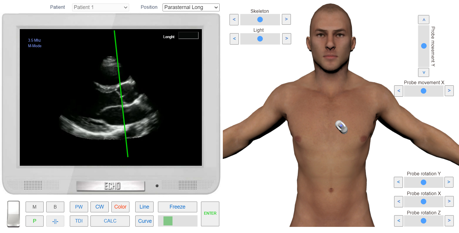 one-dimensional EXAMINATION OF THE AORTA AND AORTIC VALVE