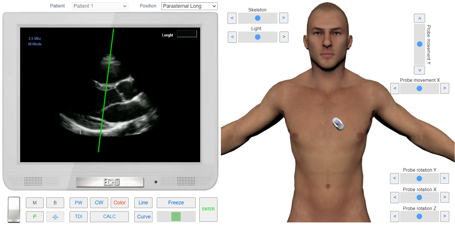 M-modal examination of the mitral valve