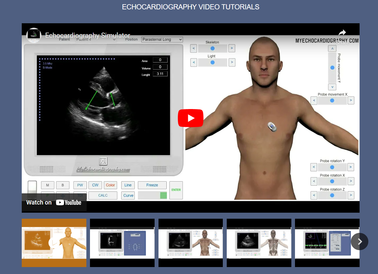 Virtual Echocardiography